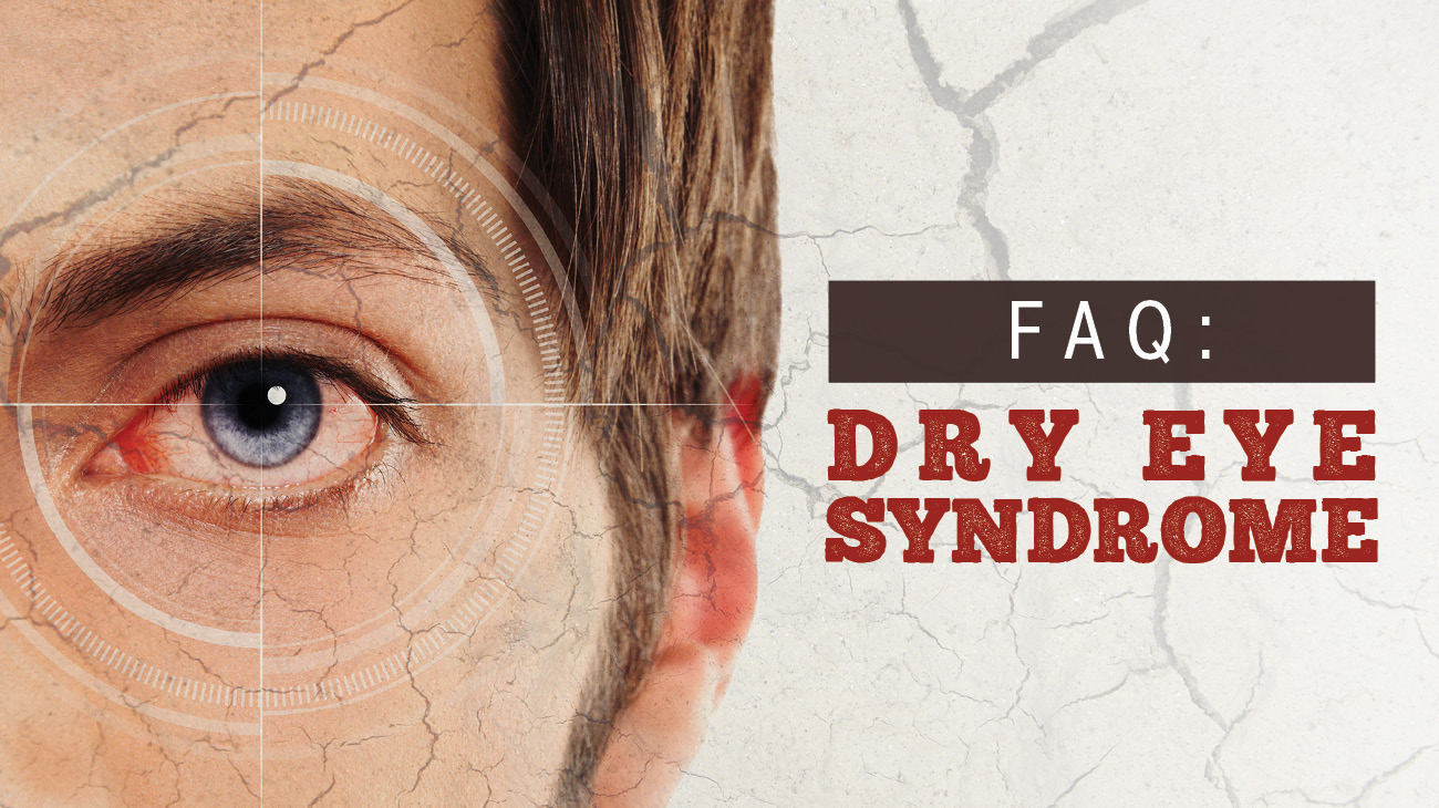 Dry Eye Syndrome: Know the Facts | Contact our office!